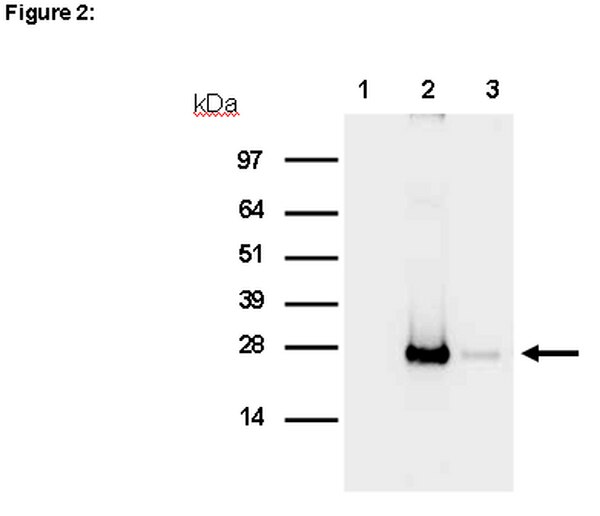 RIPAb+™ Phospho-eIF4E (Ser209) - RIP Validated Antibody and Primer Set ...